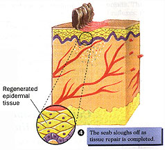 Healing the Skin: Cuts & Burns